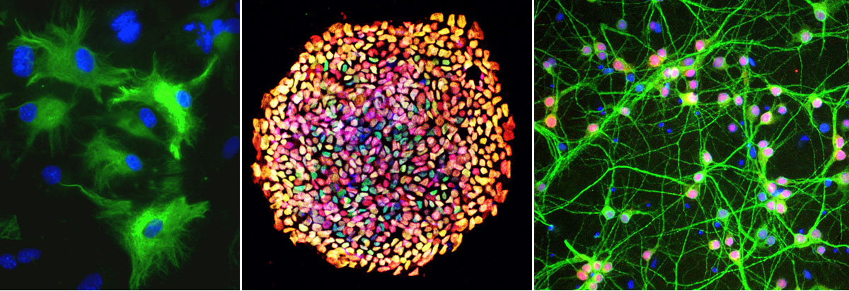 Fujifilm Cellular Dynamics Expands Neuroscience Portfolio with iPSC ...