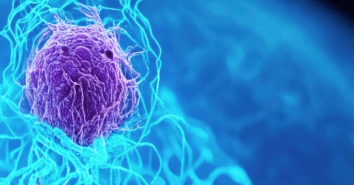 Anixa Biosciences Signs CDMO Deal with Cytovance for Phase 2 Breast ...